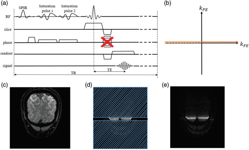This demonstrates the feasibility of line-scanning in humans. Further ...