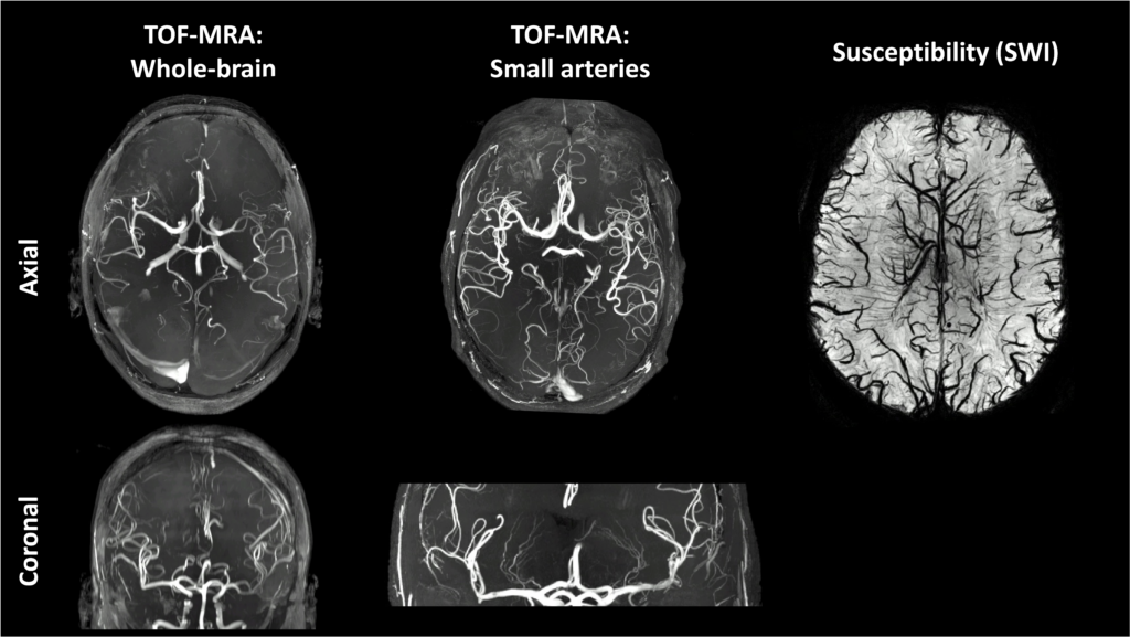 some example mri data acquired using standard protocols at 7t are shown ...